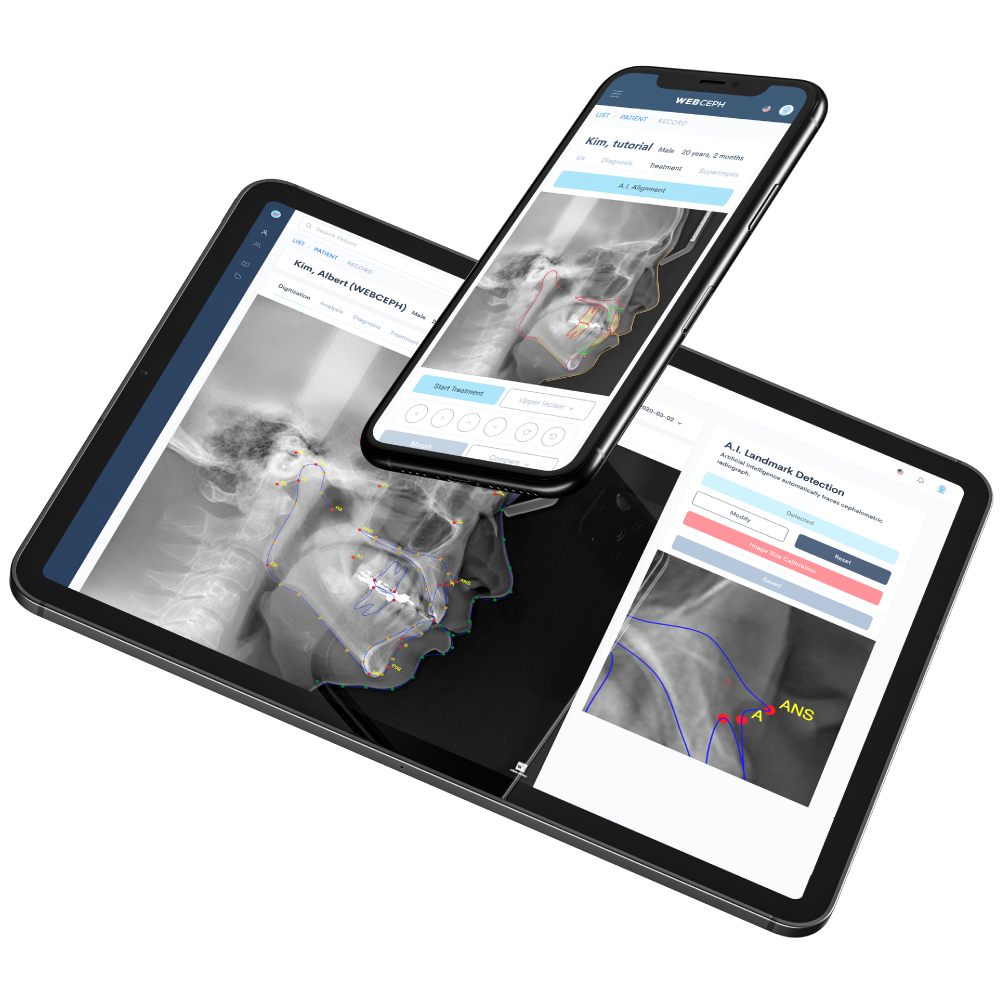 WebCeph | Ortodoncia por Inteligencia Artificial y Plataforma de Ortognática en la Nube